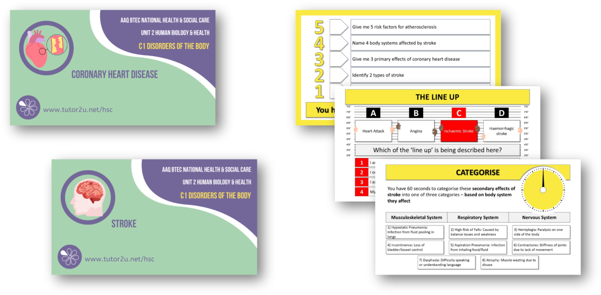 C1.1 CHD and C1.2 Stroke Topic PowerPoints and Interactive Games | Unit ...